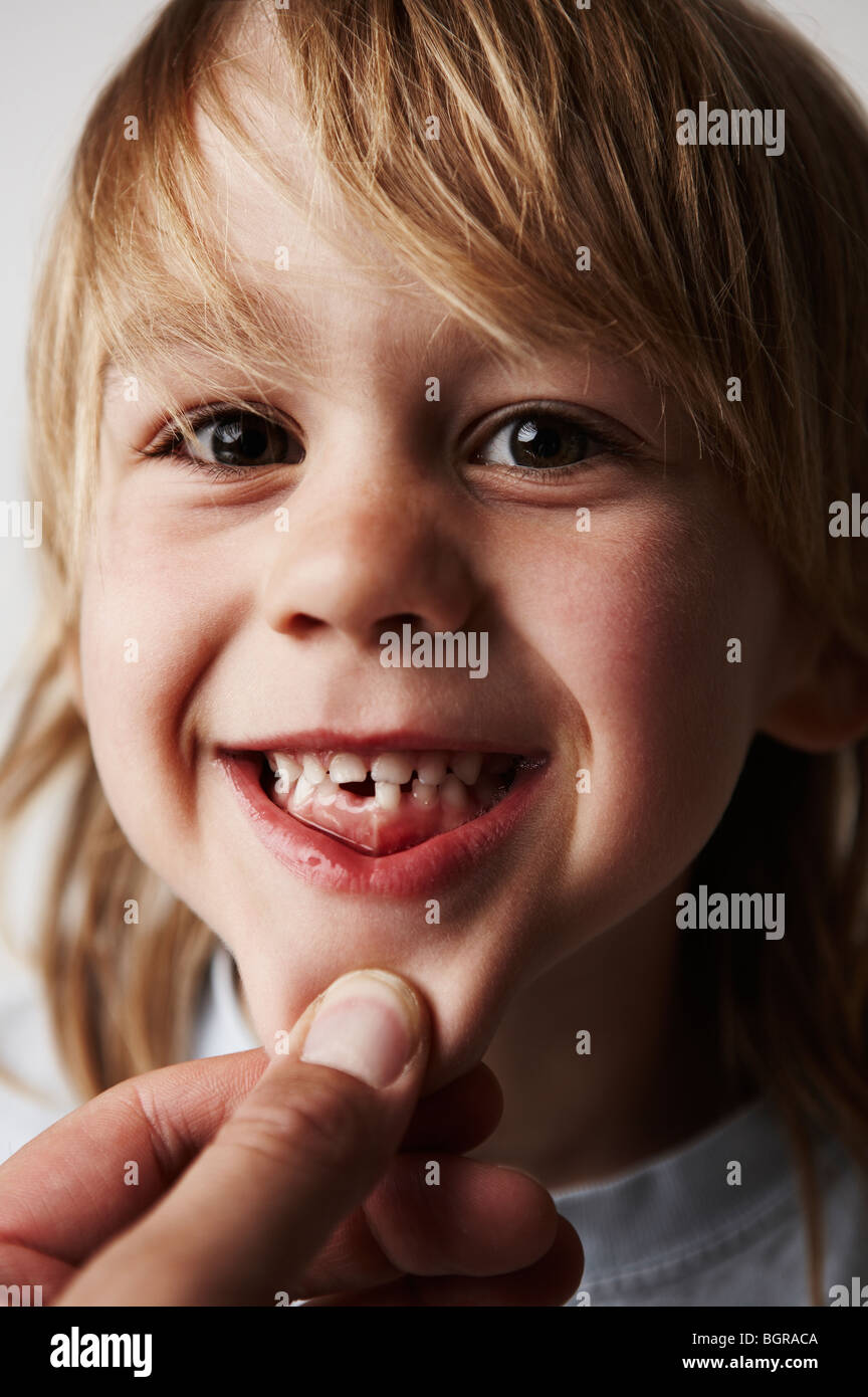 Portrait of a boy missing a tooth Stock Photo - Alamy