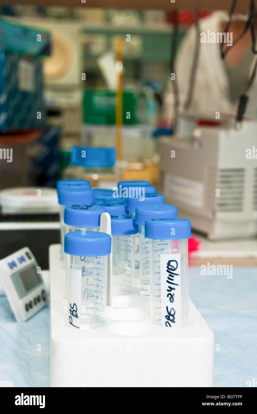 Marked test tubes in a Microbiology Laboratory Stock Photo - Alamy