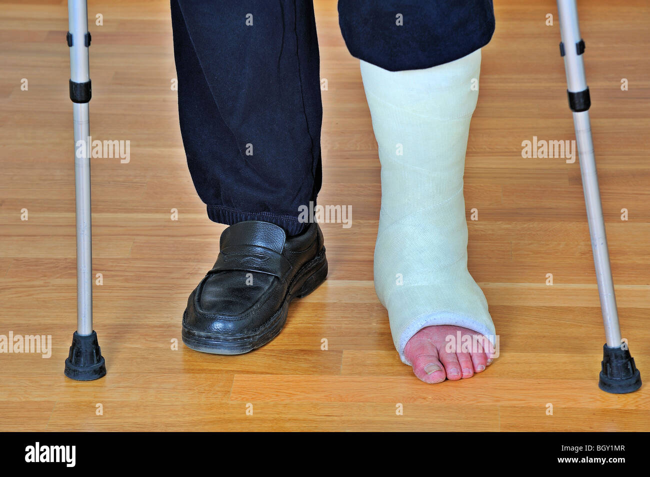 Crippled legs and feet hi-res stock photography and images - Alamy