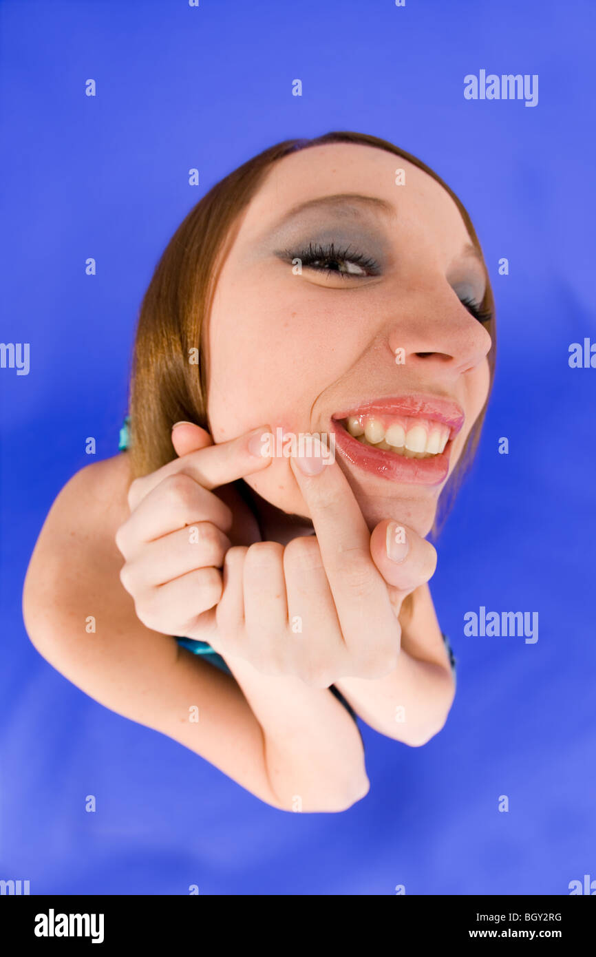 Female suffering with acme on her face Stock Photo - Alamy