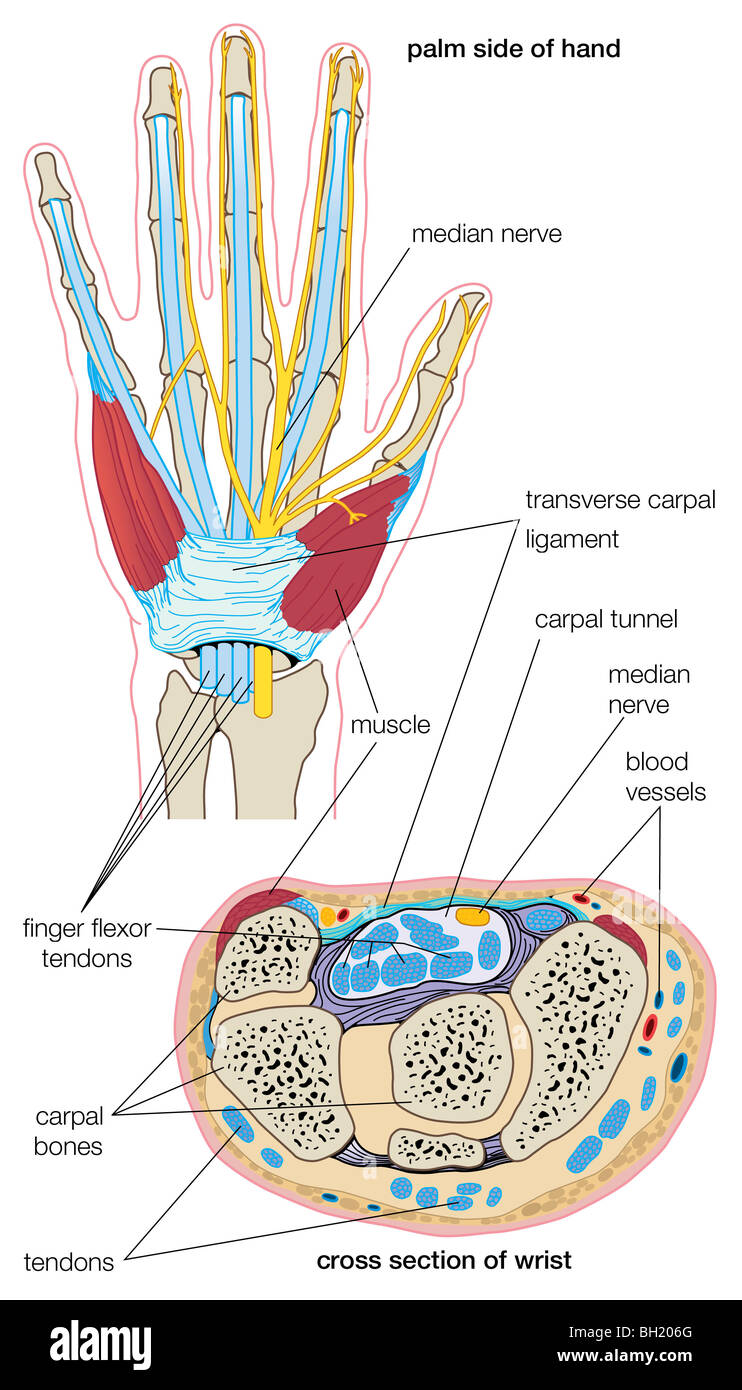Carpal tunnel syndrome Stock Photo - Alamy
