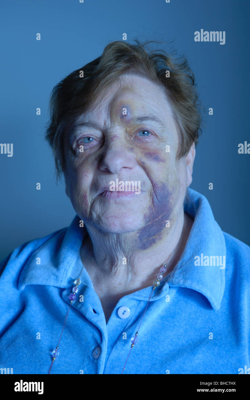 Elderly Womens Injured After Fall Stock Photo - Alamy