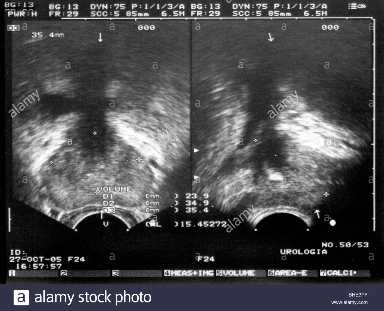 Prostate Examination Stock Photos & Prostate Examination Stock Images ...