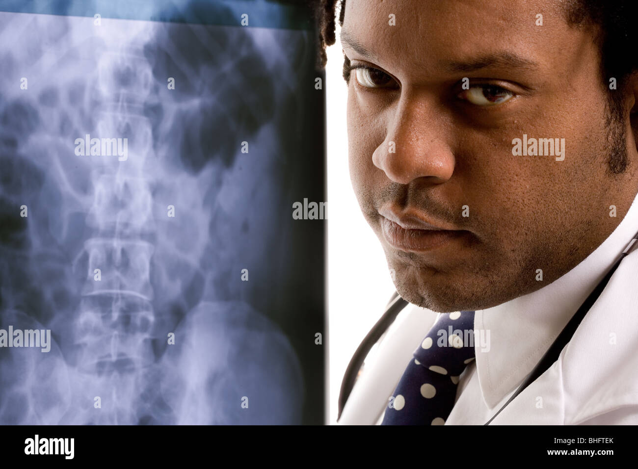 Spine x ray hi-res stock photography and images - Alamy