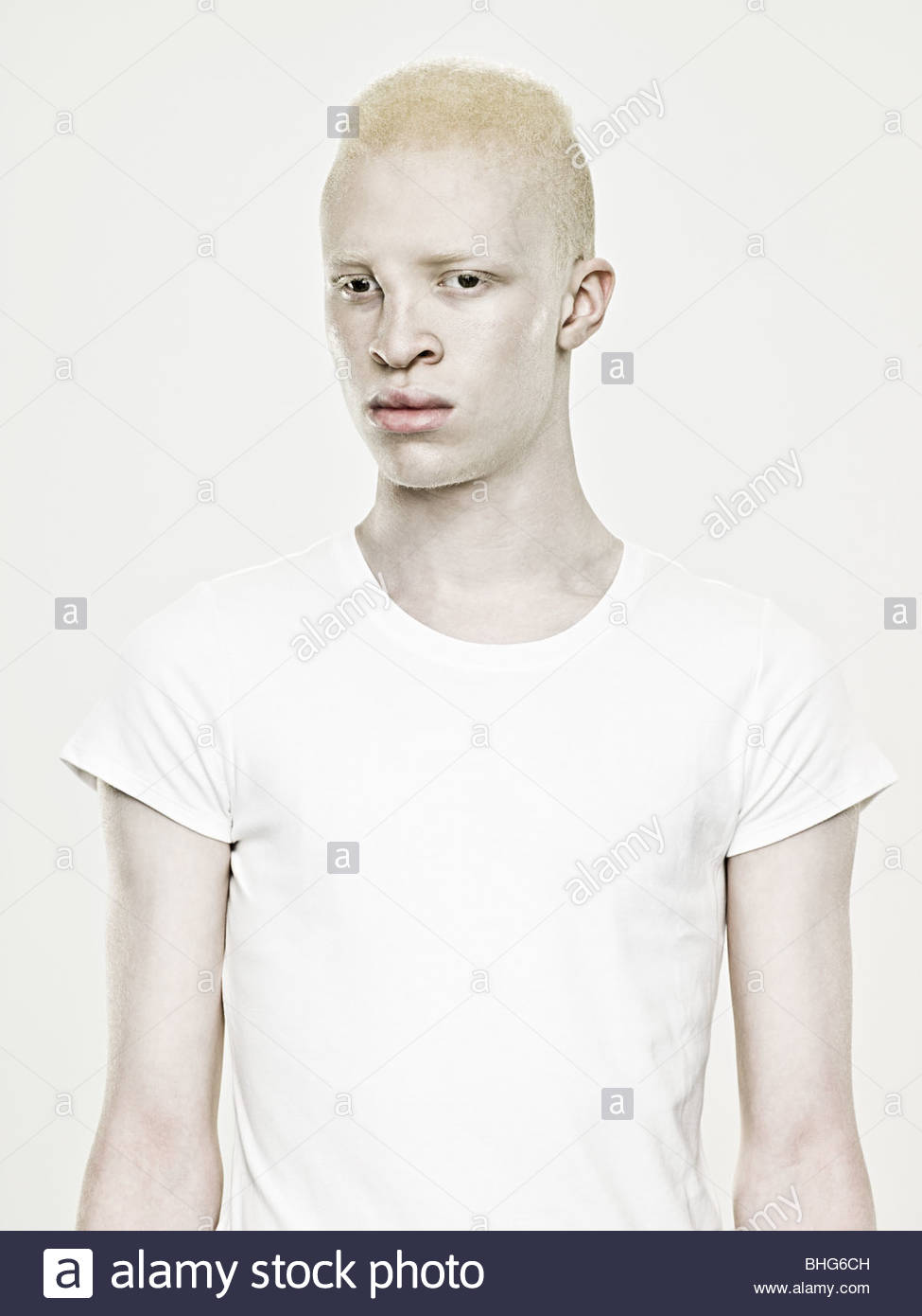 African Albino Stock Photos & African Albino Stock Images - Alamy