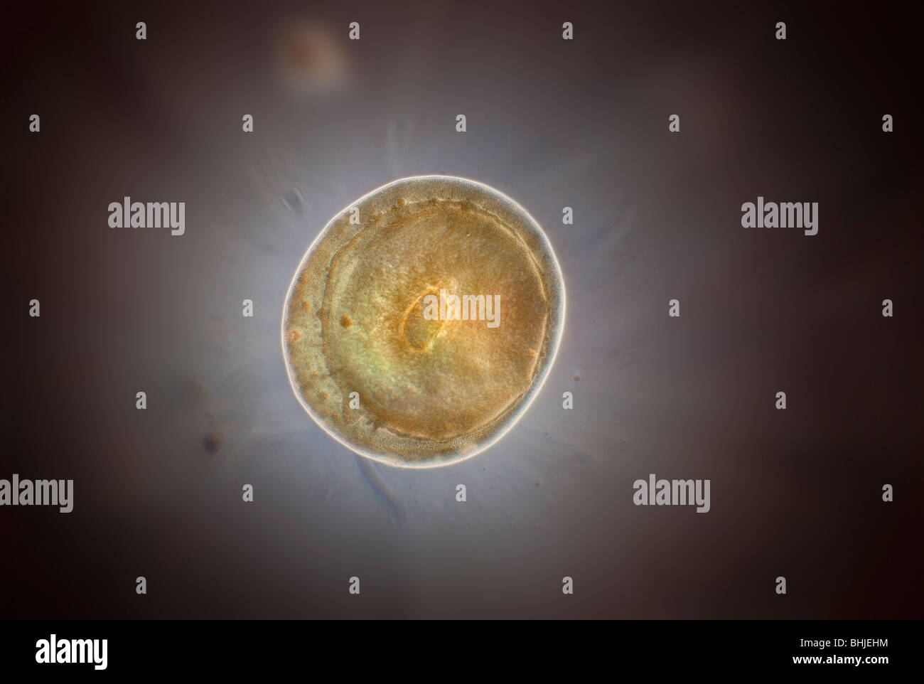 Arcella vulgaris hi-res stock photography and images - Alamy