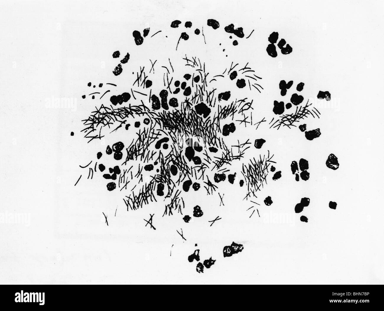 medicine, pandemic diseases, tuberculosis, Mycobacterium tuberculosis ...