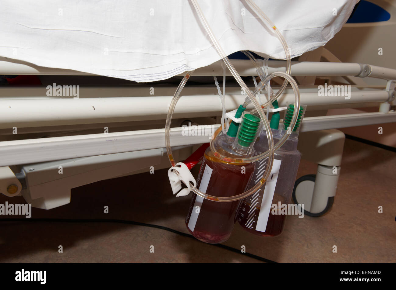 Wound drainage vessels for blood and leakages Stock Photo - Alamy