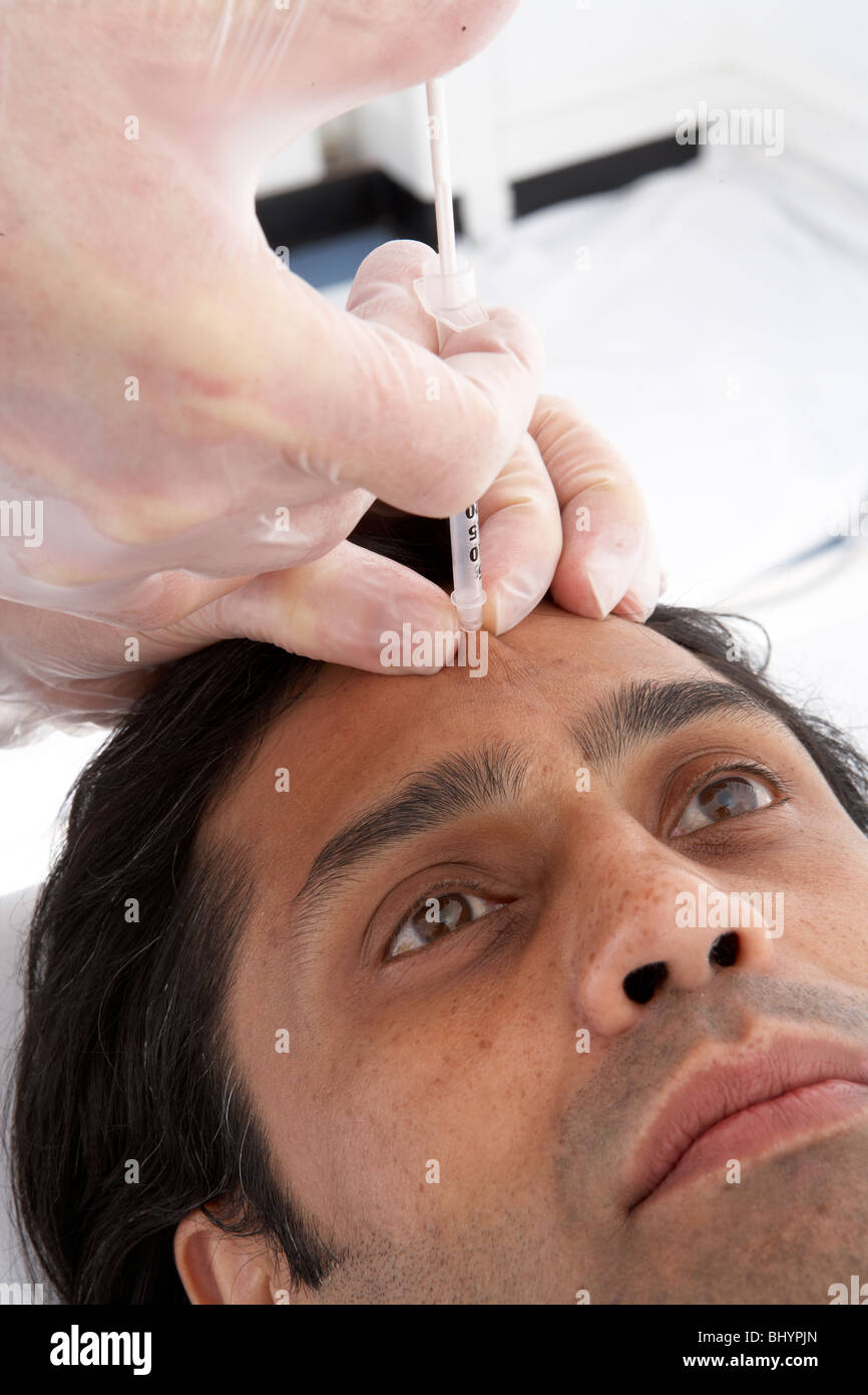 M.Frontalis central botox injection site Stock Photo - Alamy