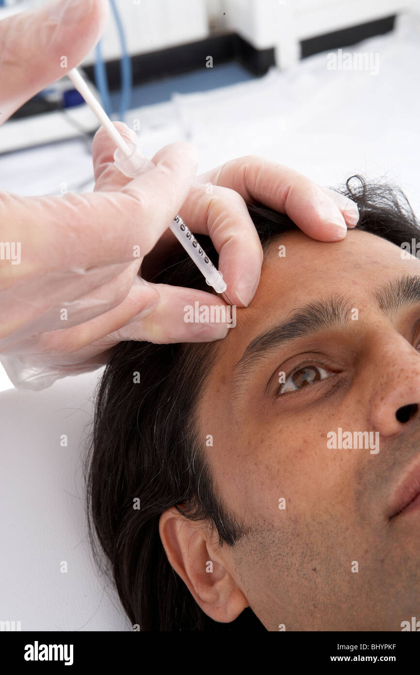 M.Frontalis Botox injection site Stock Photo - Alamy