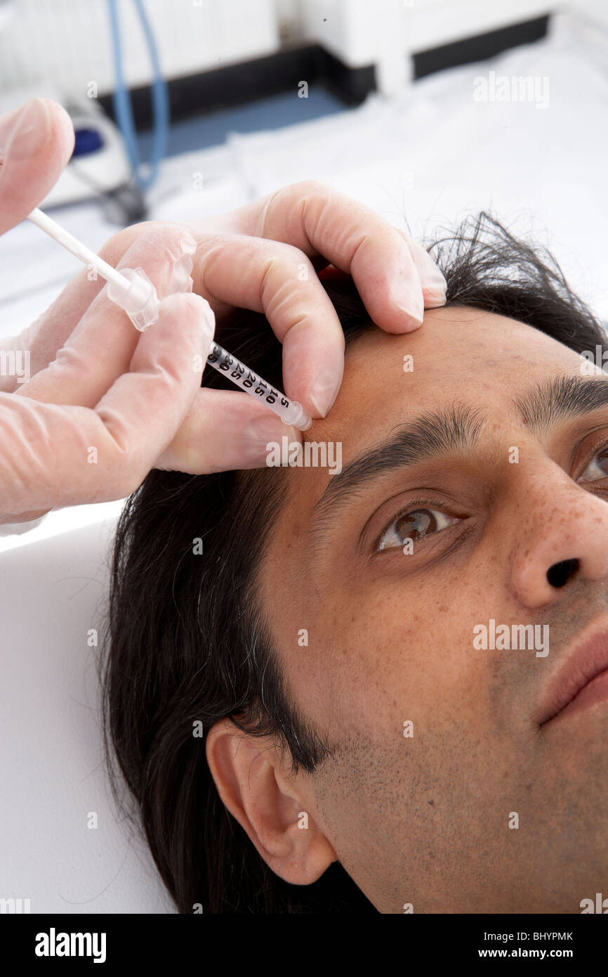 M.Frontalis (EPIC li Botox injection site Stock Photo - Alamy