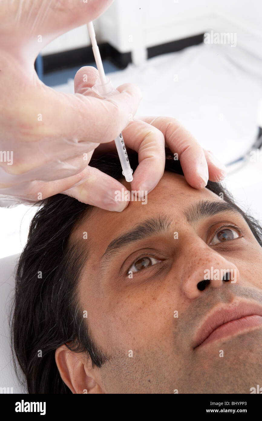 botox injection sites Stock Photo - Alamy