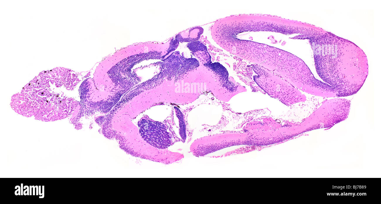 Brightfield photomicrograph of brain of frog (LS Stock Photo - Alamy