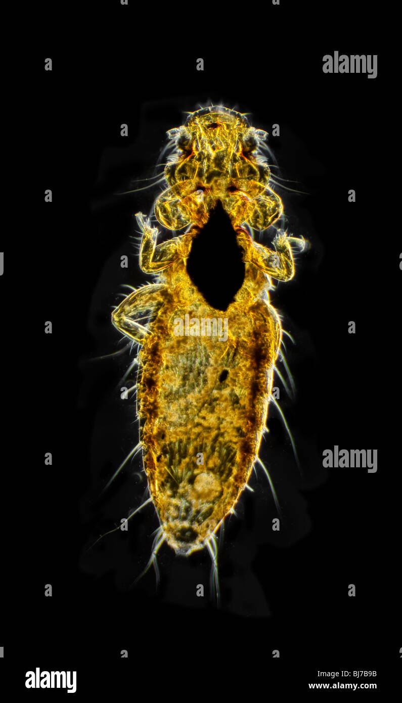 Bird louse hi-res stock photography and images - Alamy