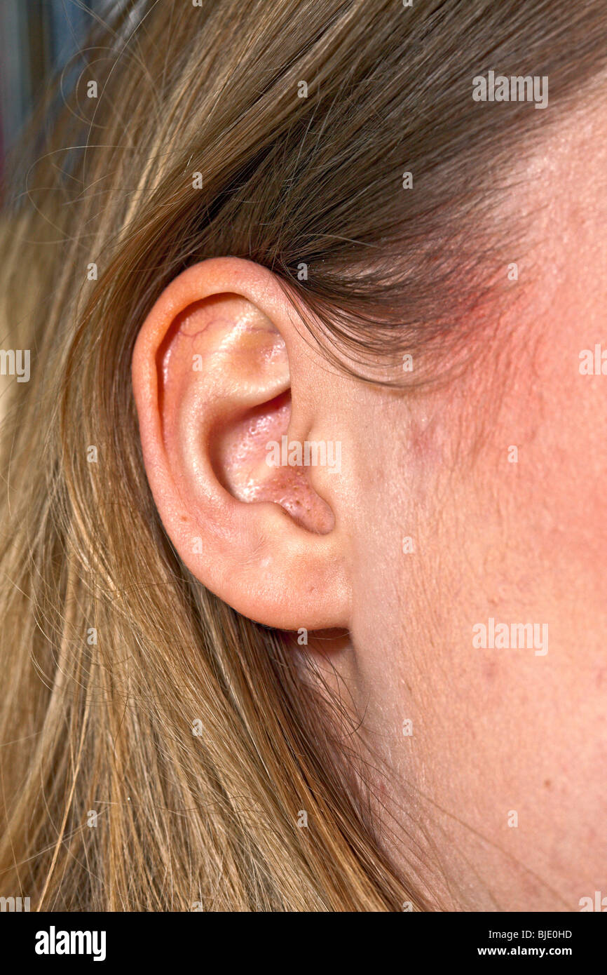 Ear Pinna High Resolution Stock Photography and Images - Alamy