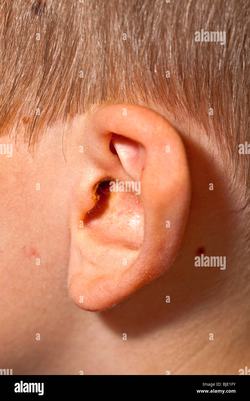 photograph of a child's ear Stock Photo - Alamy