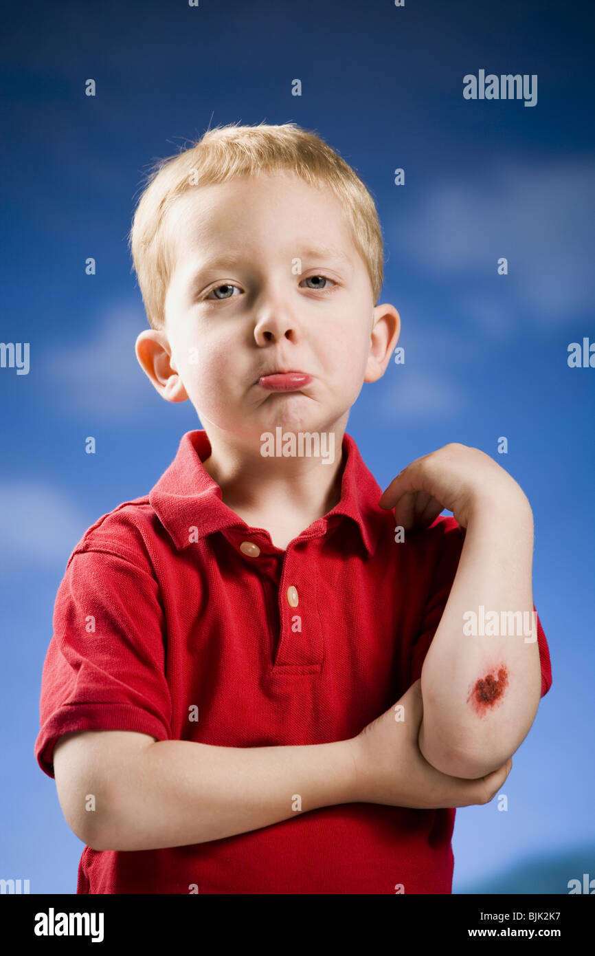 Boy with scraped elbow Stock Photo - Alamy