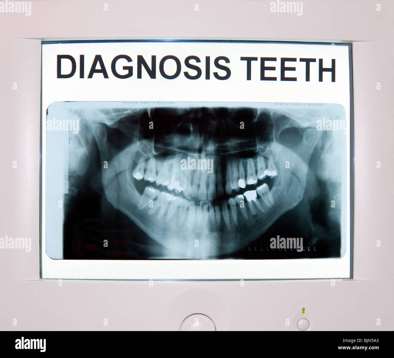 Ray identification hi-res stock photography and images - Alamy