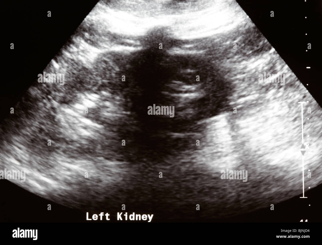 Human kidney hi-res stock photography and images - Alamy