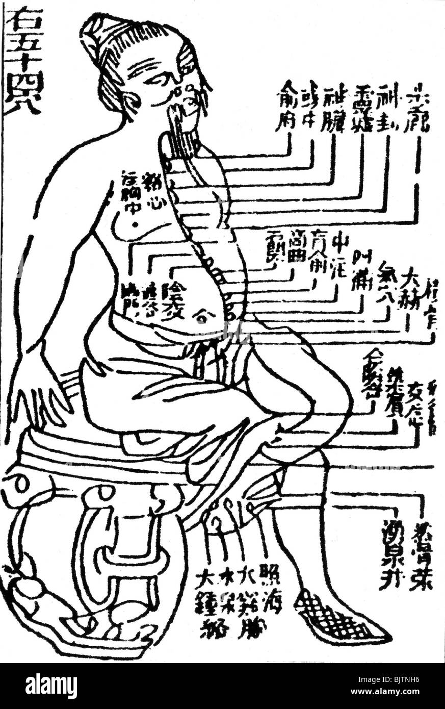 Acupuncture drawing hi-res stock photography and images - Alamy