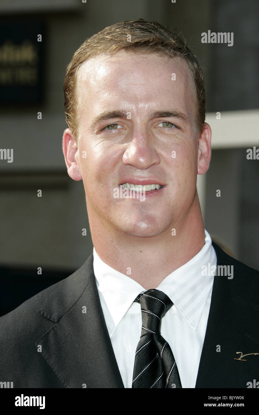 Peyton Manning Cleft Lip