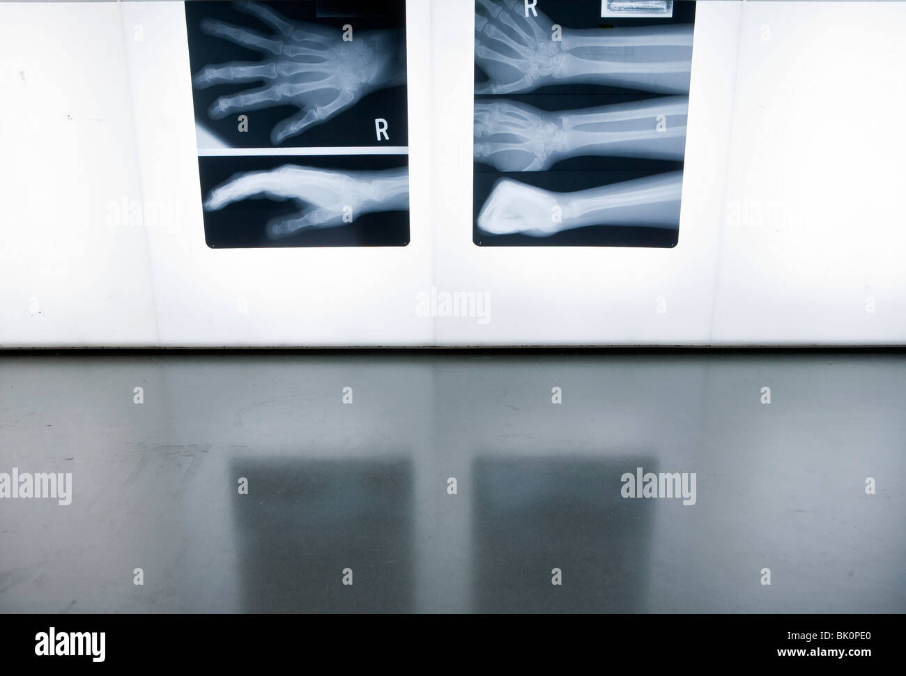 First human x ray hi-res stock photography and images - Alamy