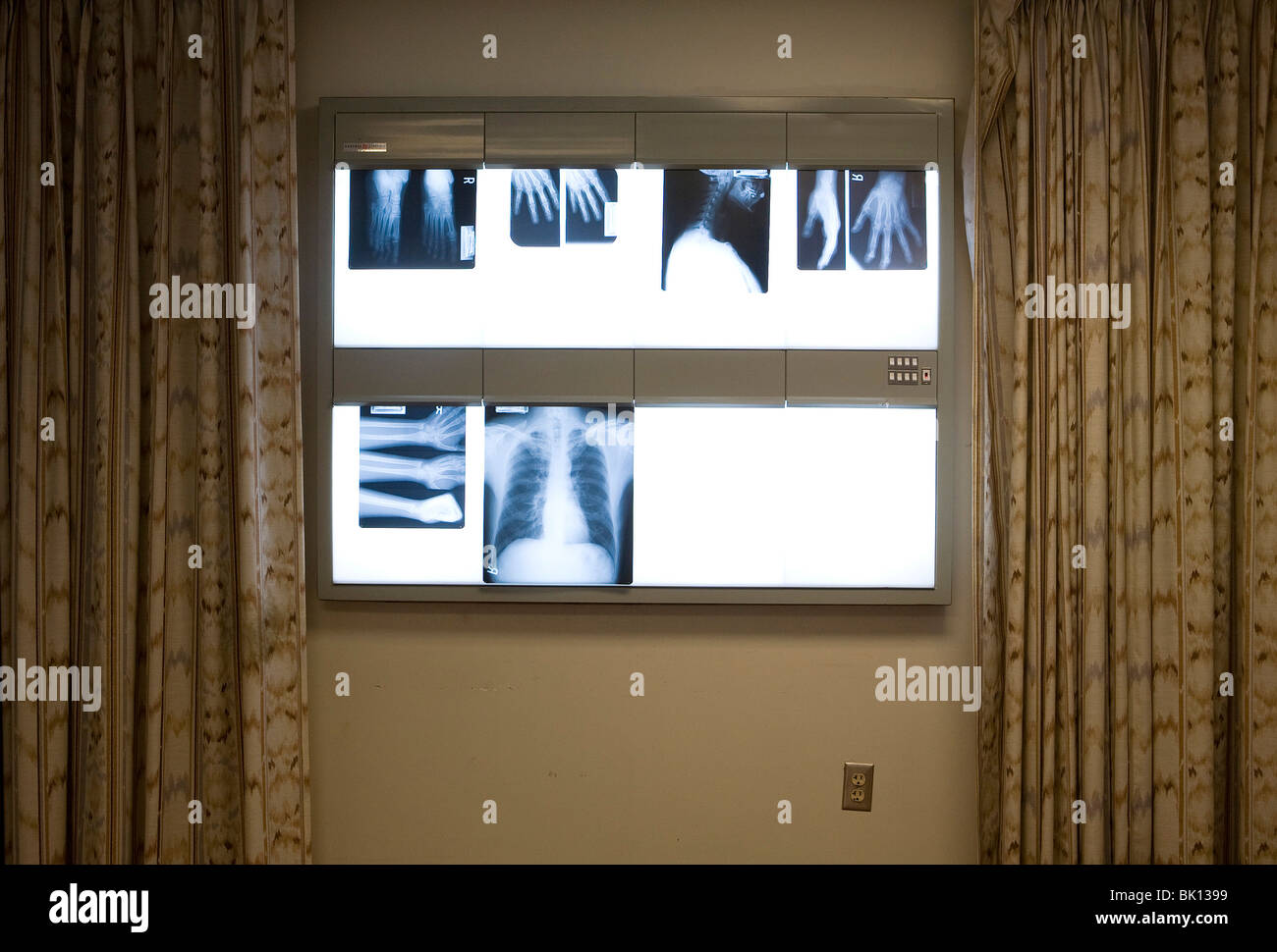 X-rays in a doctors office Stock Photo - Alamy