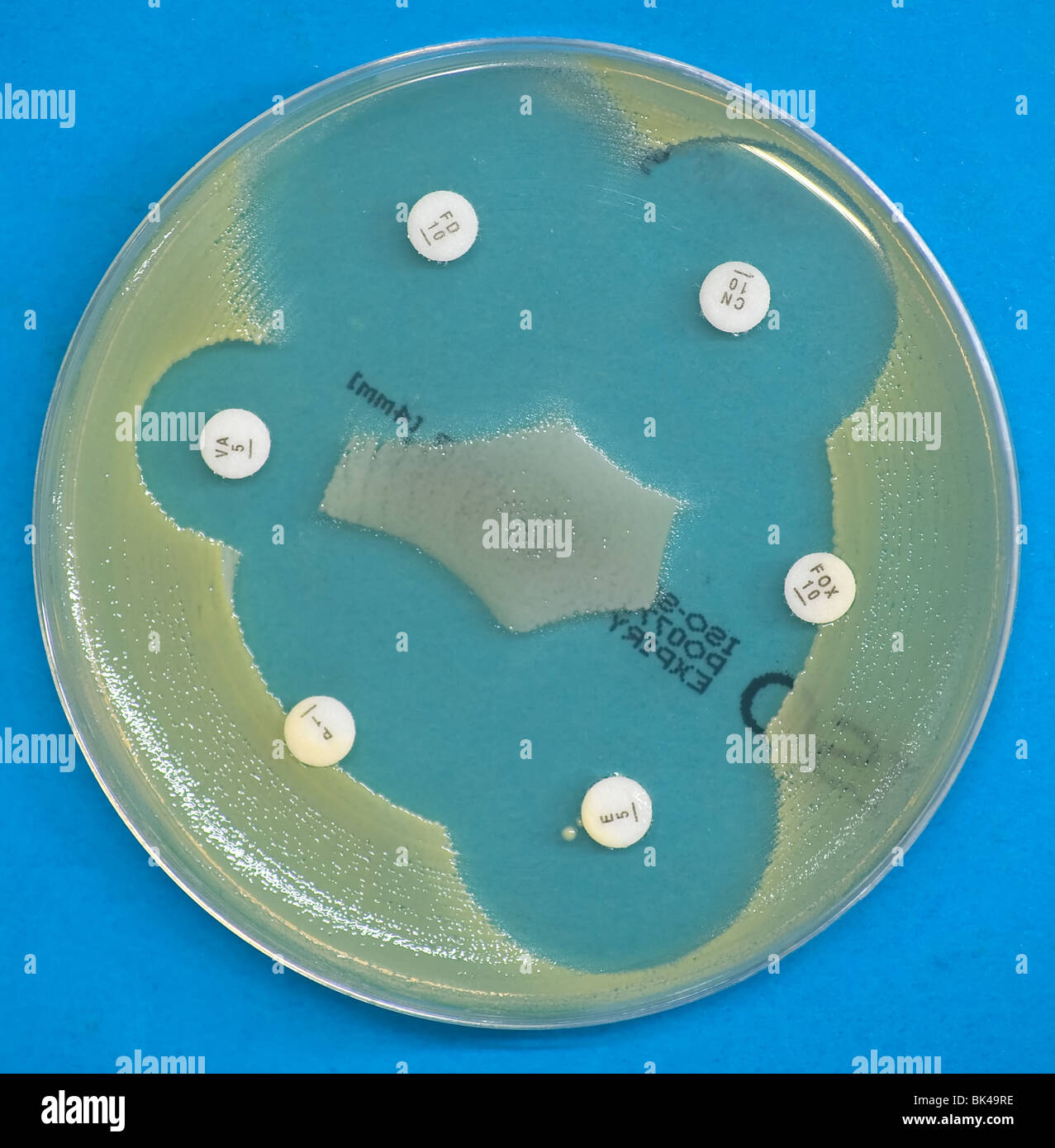 Susceptibility plate of an MRSA strain Stock Photo - Alamy Susceptibility plate of an MRSA strain Stock Photo - Alamy