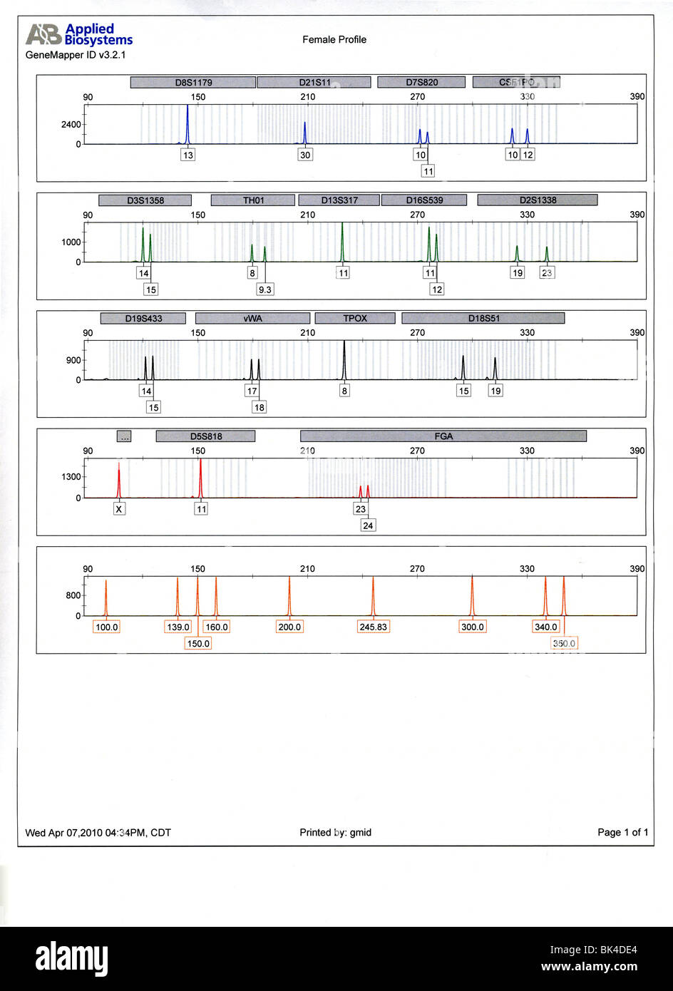 Dna profile hi-res stock photography and images - Alamy