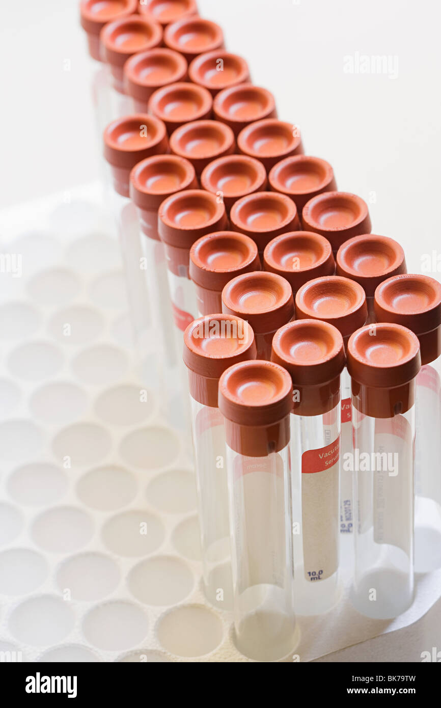 Tubes tests hi-res stock photography and images - Alamy