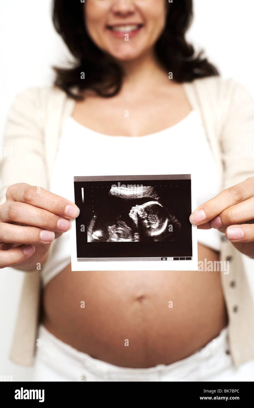 Pregnant woman holding her baby scan Stock Photo - Alamy