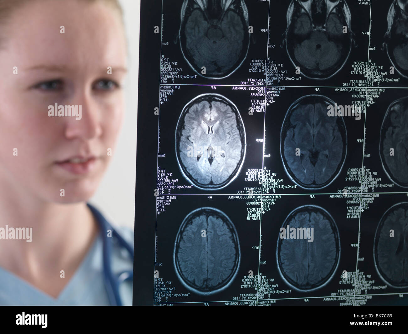 Doctor studying an MRI scan Stock Photo - Alamy