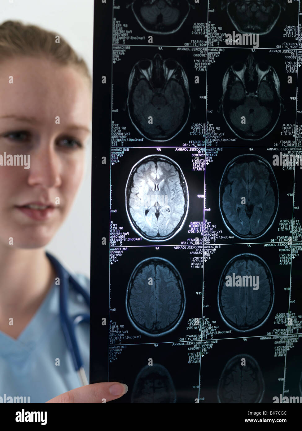Doctor studying an MRI scan Stock Photo - Alamy