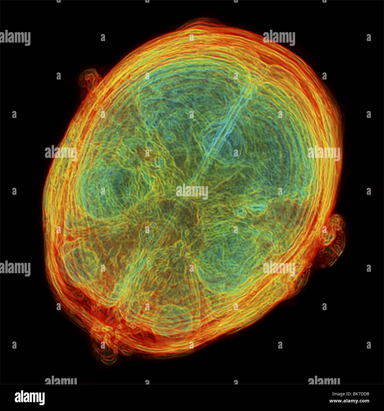 Human brain, 3D-MRI scan Stock Photo - Alamy