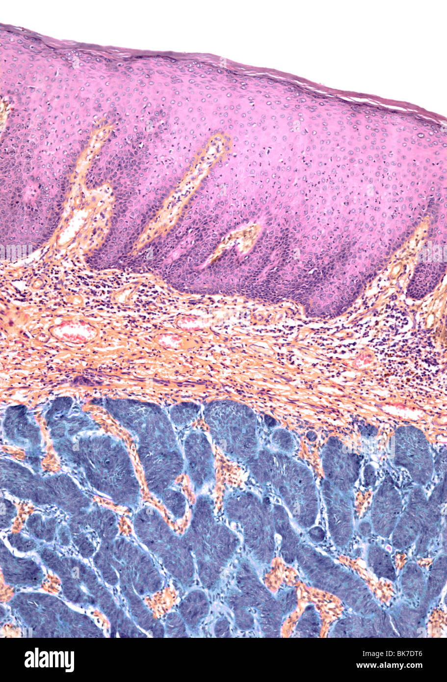 Skin cells magnified hi-res stock photography and images - Alamy