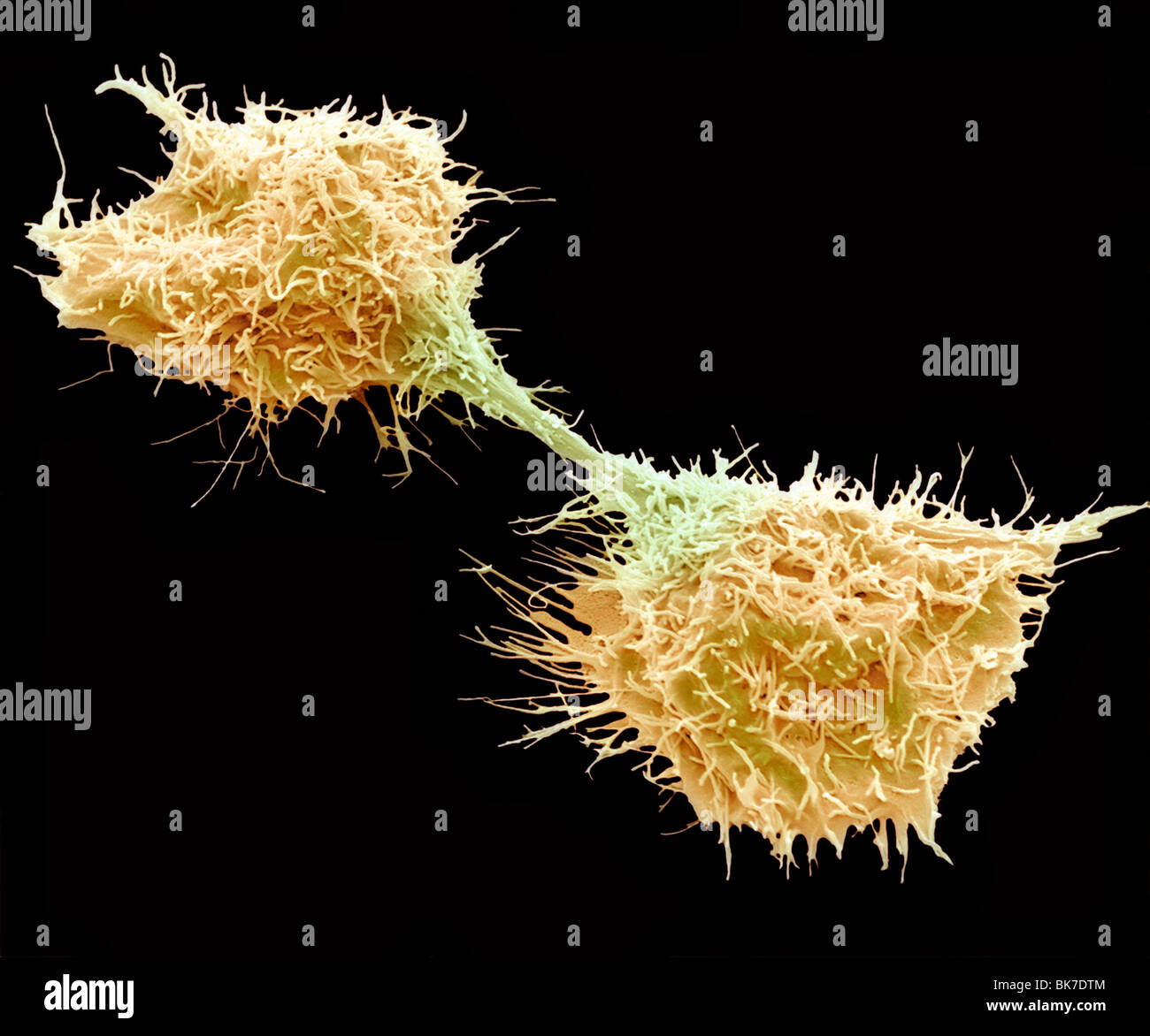 Dividing fibrosarcoma cells, SEM Stock Photo - Alamy