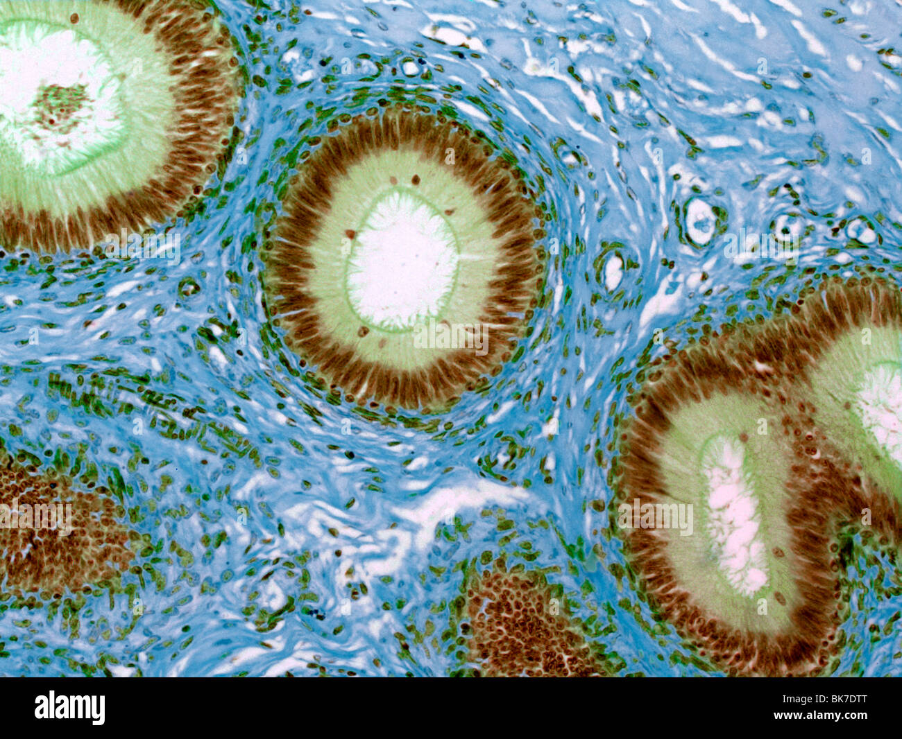 Epididymis, light micrograph Stock Photo - Alamy