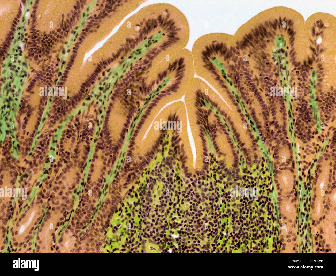 Lymph nodes micrograph hi-res stock photography and images - Alamy