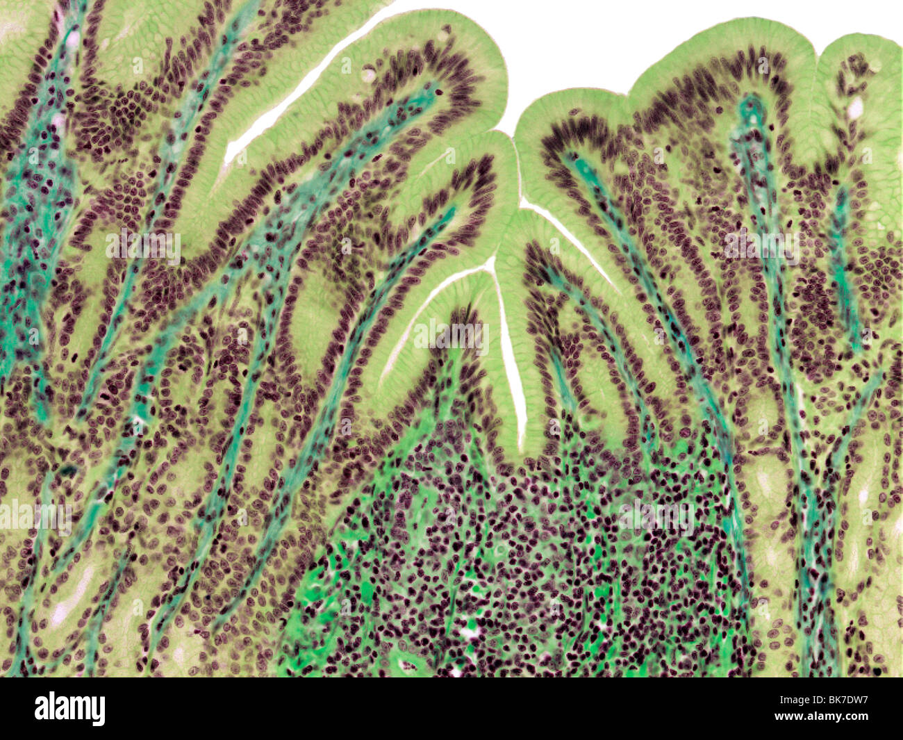 Lymph node micrograph hi-res stock photography and images - Alamy