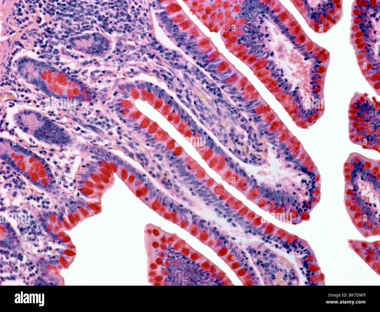 Colon lining, light micrograph Stock Photo - Alamy