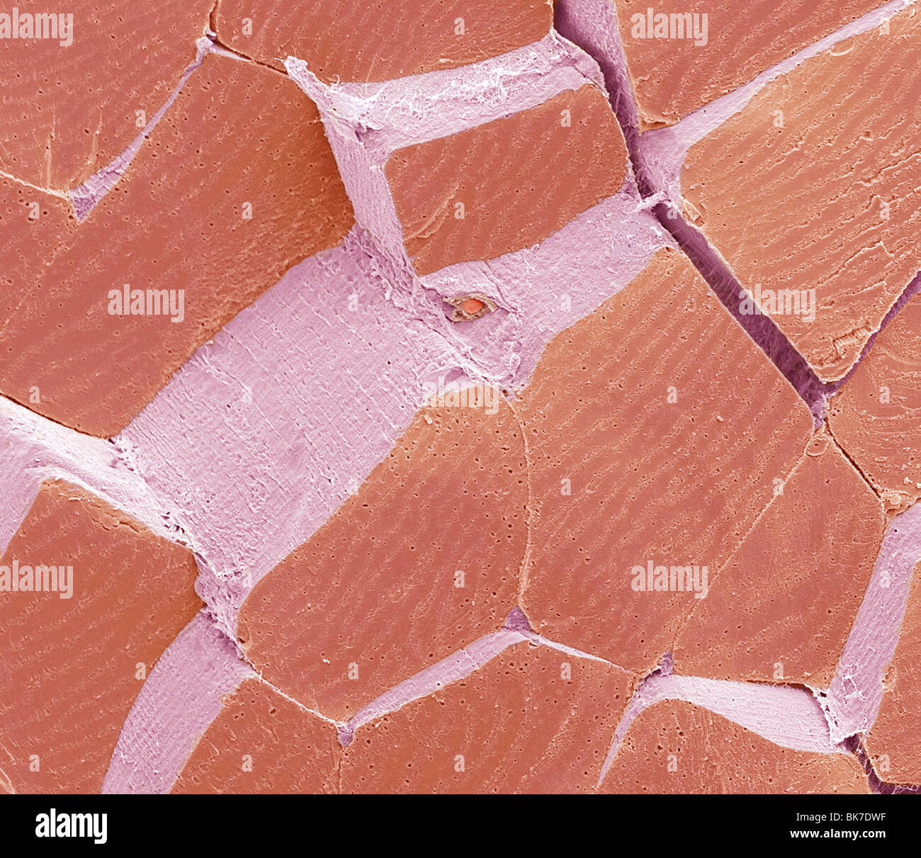 Skeletal muscle fiber hi-res stock photography and images - Alamy