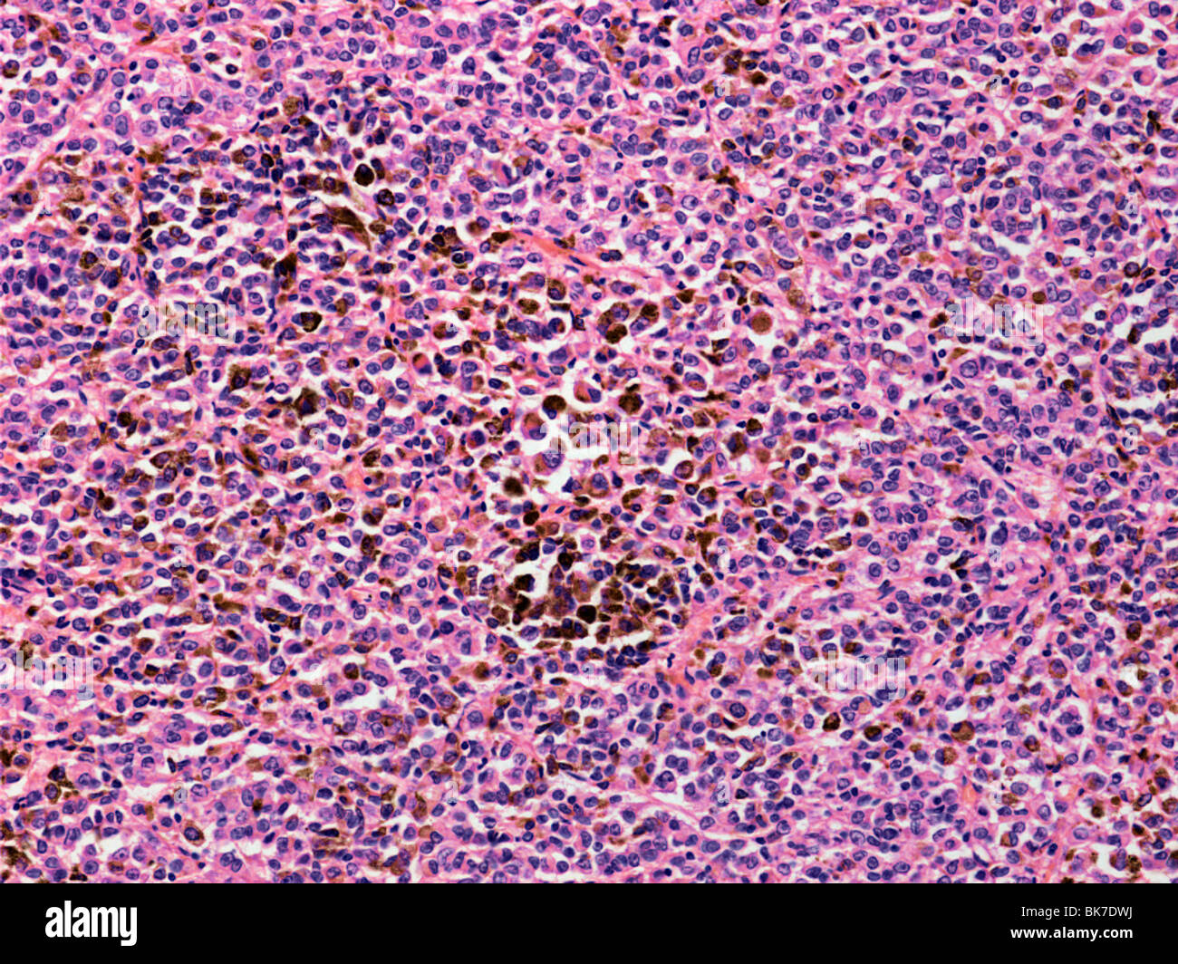Livers cells hi-res stock photography and images - Alamy
