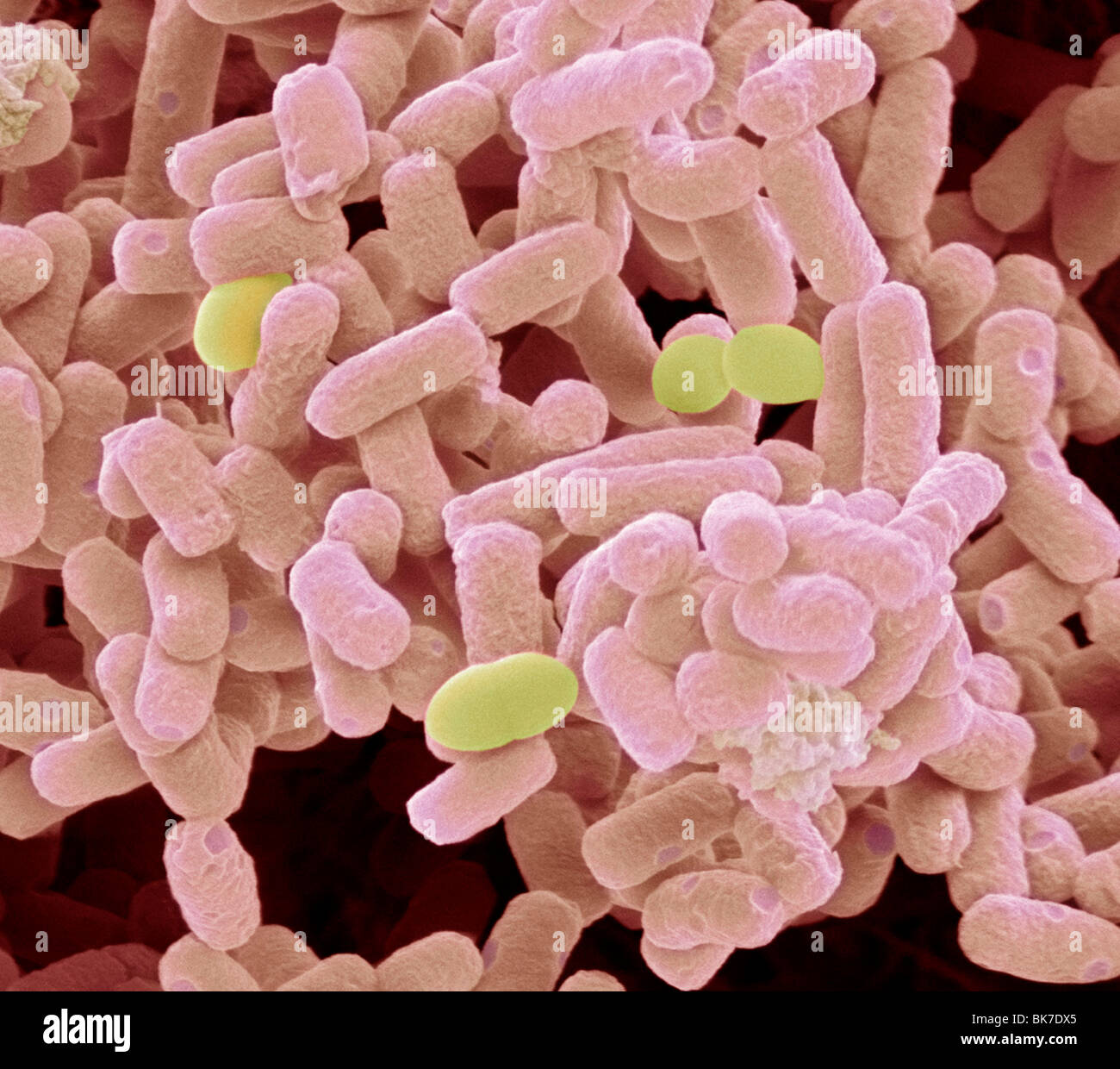 Escherichia coli light micrograph hi-res stock photography and images ...