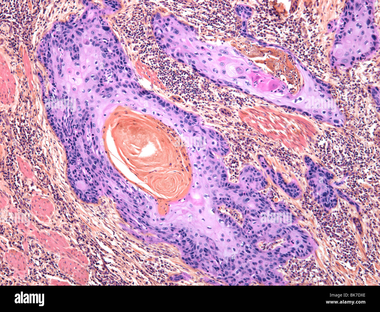 Human skin cell light micrograph hi-res stock photography and images ...