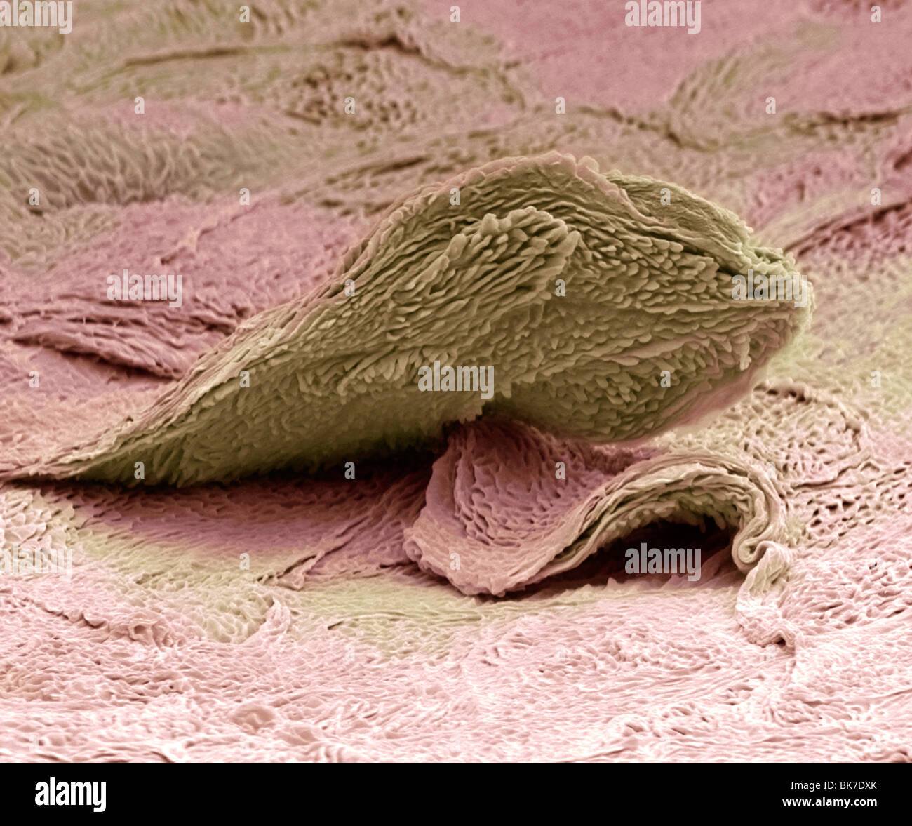Human skin cells magnified hi-res stock photography and images - Alamy