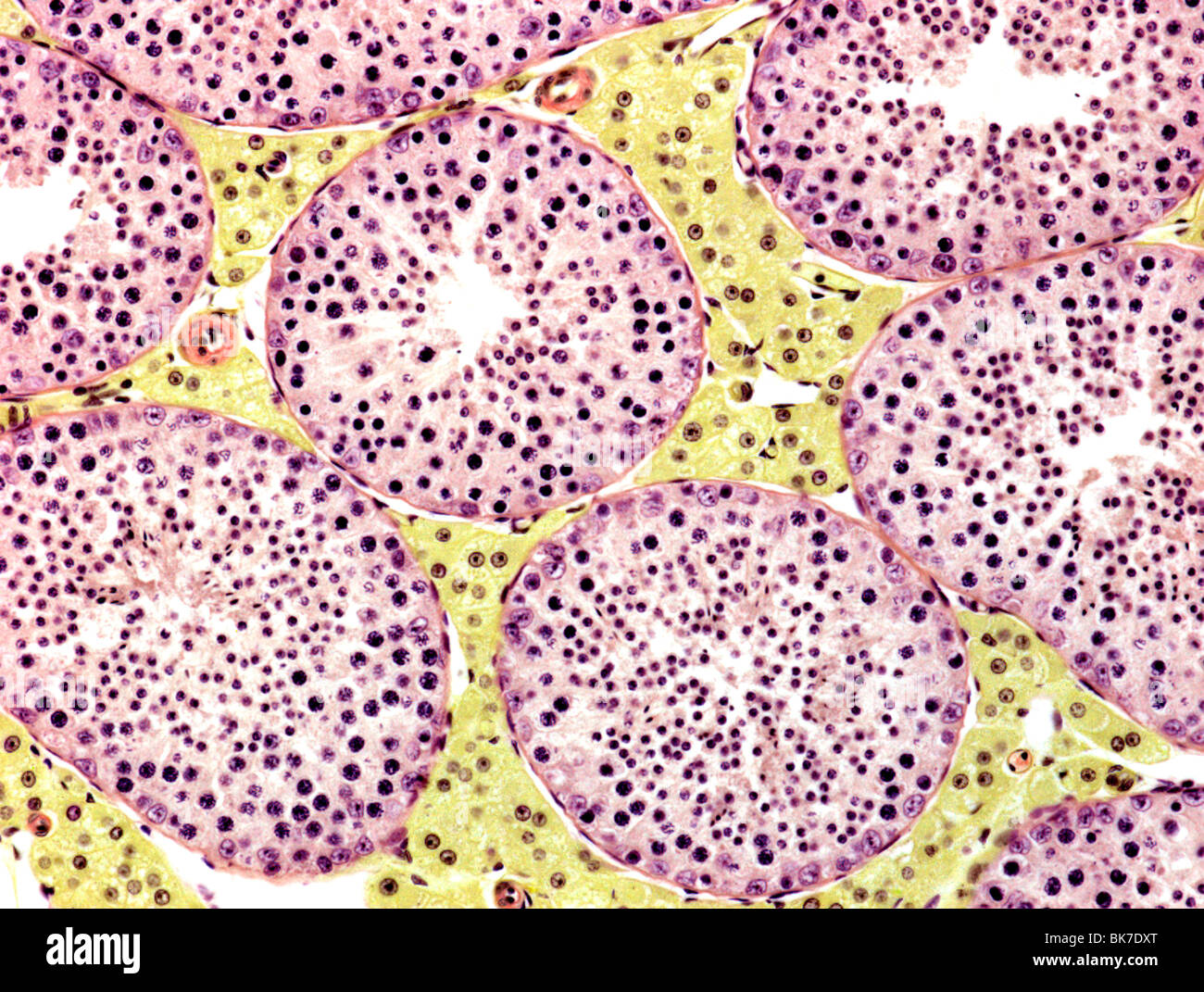 Testis Histology Seminiferous Tubules