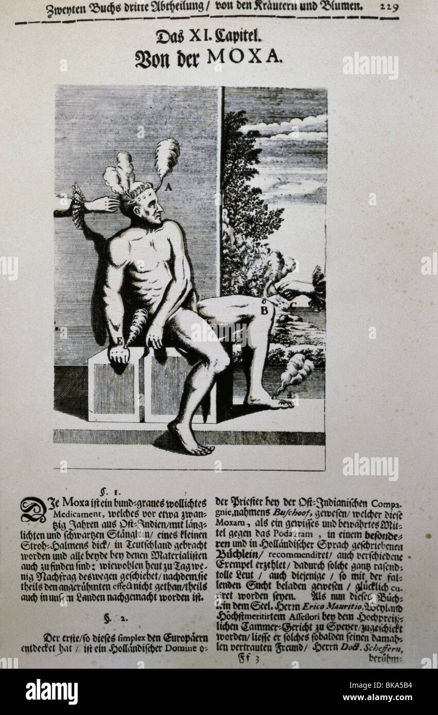 medicine, treatment, moxibustion, illustration from "Museum museorum ...