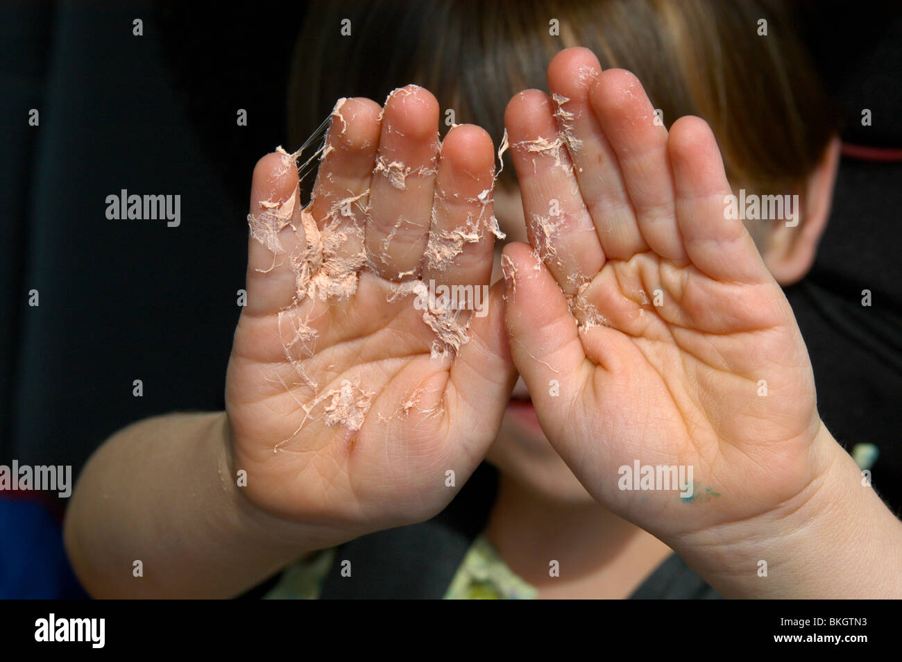 Gum on child's hands Stock Photo - Alamy