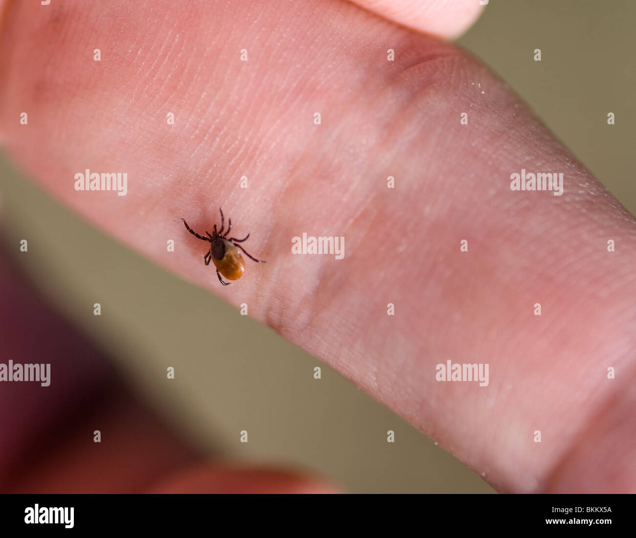 Tick Crawling On Human Skin High Resolution Stock Photography and ...