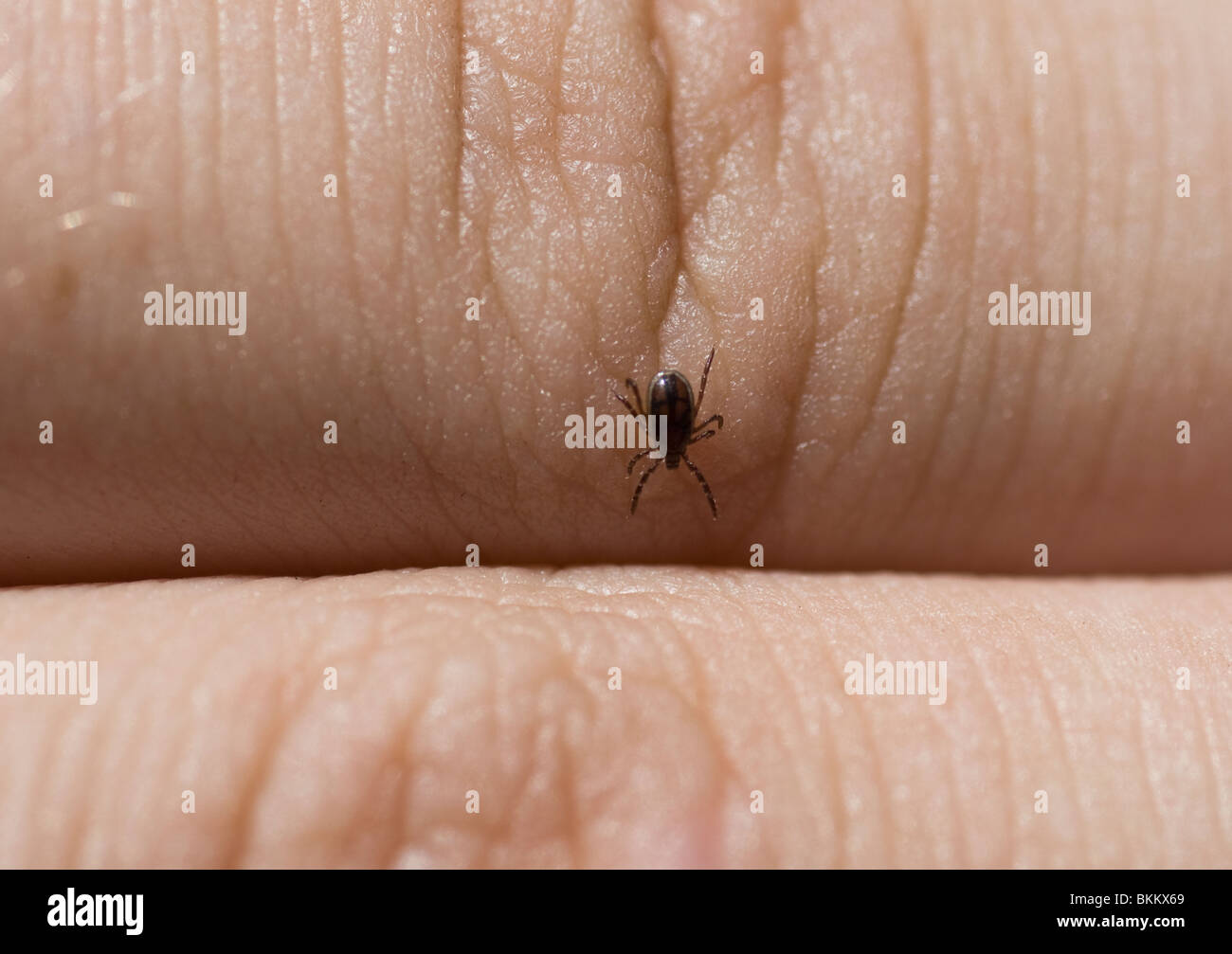 Tick on finger hi-res stock photography and images - Alamy
